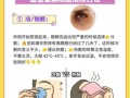 如何去除黑眼圈最快方法_黑眼圈怎么快速消除