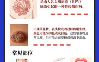 菜花病是怎么引起的_菜花病是什么引起的