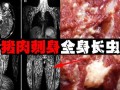 猪肉绦虫病的症状_如何预防