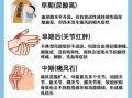 男性尿酸高的早期症状_如何判断