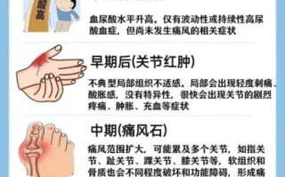 男性尿酸高的早期症状_如何判断