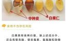 长期少量吃白果有什么危害_白果每天吃多少才安全