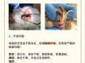 兔肉综合症是什么_兔肉综合症如何预防