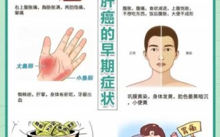 肝病早期有哪些症状_肝病七个征兆是什么