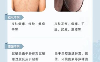过敏性皮炎图片和症状_怎么判断是不是过敏性皮炎