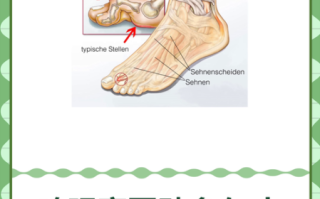 鸡眼贴自然脱落还是要挖开_鸡眼贴多久能掉