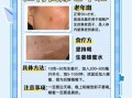 老年斑怎么去除最有效_老年斑消除最好的方法