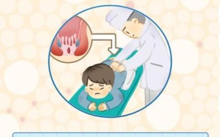 大便后擦屁股纸上会有血怎么回事_肛门出血原因
