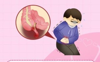 阑尾炎不能吃什么食物_术后饮食禁忌