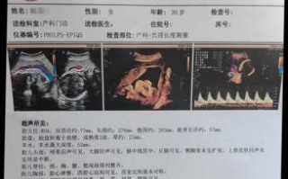 小排畸什么时候做_小排畸检查几周做最好