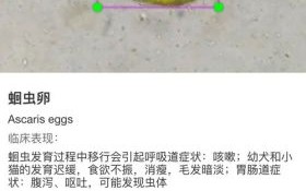 如何判断自己体内有寄生虫_寄生虫检测方法有哪些