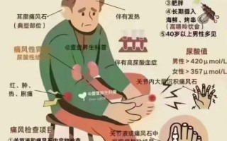 为什么打完飞机就犯痛风_痛风发作与手淫关系