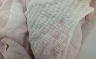 猪皮吃了两个月皮肤变好了_猪皮美容真的有用吗