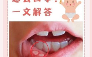 嘴上起泡怎样快速下去_嘴角起泡几天能好