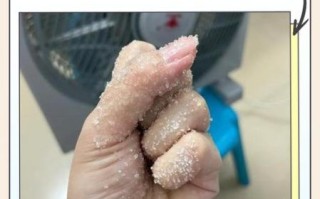 手切辣椒疼怎么办_辣椒辣手最快缓解方法