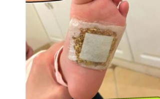 炒姜末敷脚心正确做法_敷多久见效