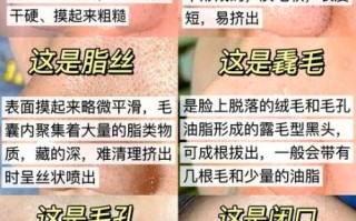蛋清去黑头真的有用吗_蛋清去黑头步骤