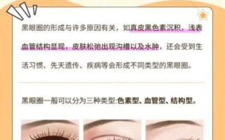 黑眼圈很重怎么消除_黑眼圈怎么快速淡化