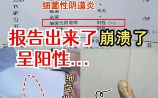 豆腐渣白带一周后自愈_豆腐渣白带能自己好吗