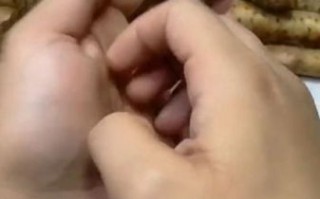 芋头手痒是什么原因_怎么处理最快止痒