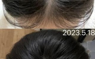 补肾粥21天白发变黑发是真的吗_如何正确熬制