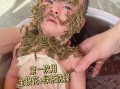 蚕豆病可以吃金银花吗_蚕豆病金银花禁忌