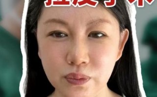 面部拉皮手术怎么做_面部拉皮能维持多久