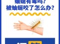 蚰蜒有毒吗_被蚰蜒咬了怎么办