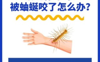 蚰蜒有毒吗_被蚰蜒咬了怎么办