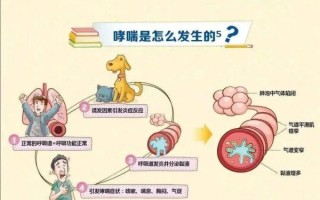 哮喘的症状有哪些_如何判断是不是哮喘