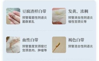 豆腐渣样分泌物是什么原因_豆腐渣样分泌物怎么治疗