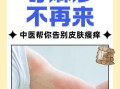荨麻疹最怕三样东西_荨麻疹怎么快速止痒