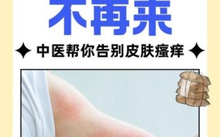 荨麻疹最怕三样东西_荨麻疹怎么快速止痒
