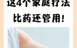 荨麻疹最快治疗方法_荨麻疹怎么止痒
