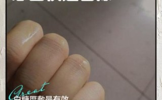 手被辣椒辣了怎么办_最快消除灼烧感