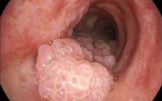 菜花病症状图片大全_菜花病初期长什么样