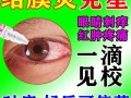 过敏性结膜炎怎么根治_过敏性结膜炎用什么眼药水