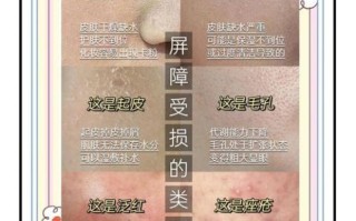 皮肤干燥脱屑像雪花怎么办_为什么皮肤会起皮屑