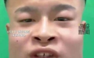 长期吃槟榔的人脸部变化_槟榔脸还能恢复吗