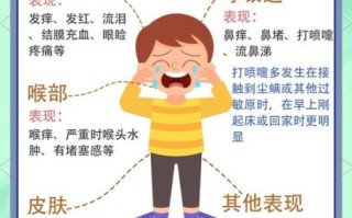 过敏症状有哪些表现_过敏症状怎么缓解 过敏症状有哪些表现_过敏症状怎么缓解