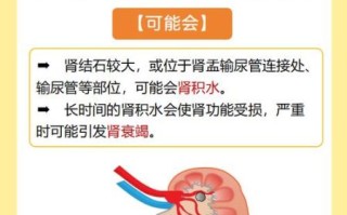 肾结石能根治吗_肾结石会影响寿命吗