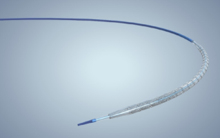 巧克力球囊是什么_巧克力球囊多少钱