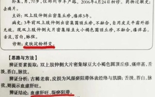 淀粉样变皮肤病偏方_淀粉样变皮肤病民间疗法