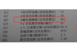 碱性磷酸酶偏高怎么办_碱性磷酸酶偏高吃什么