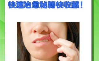 口腔溃疡一夜见效偏方_口腔溃疡怎么快速止痛