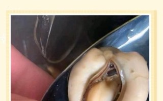 海虹怎么清洗_海虹怎么保存