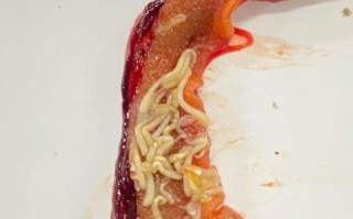 黄鳝寄生虫吃了会怎样_感染症状多久出现