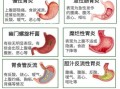 胃病从轻到重有哪些_如何区分胃病严重程度
