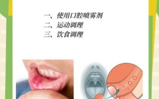 口腔溃疡怎么治最快_口腔溃疡最有效的治疗方法