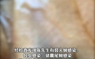 鱼生寄生虫_吃了会感染吗